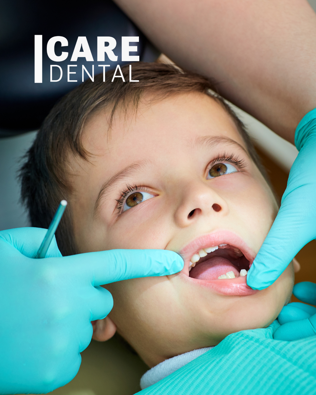 What is a Happy Visit? - Care Dental